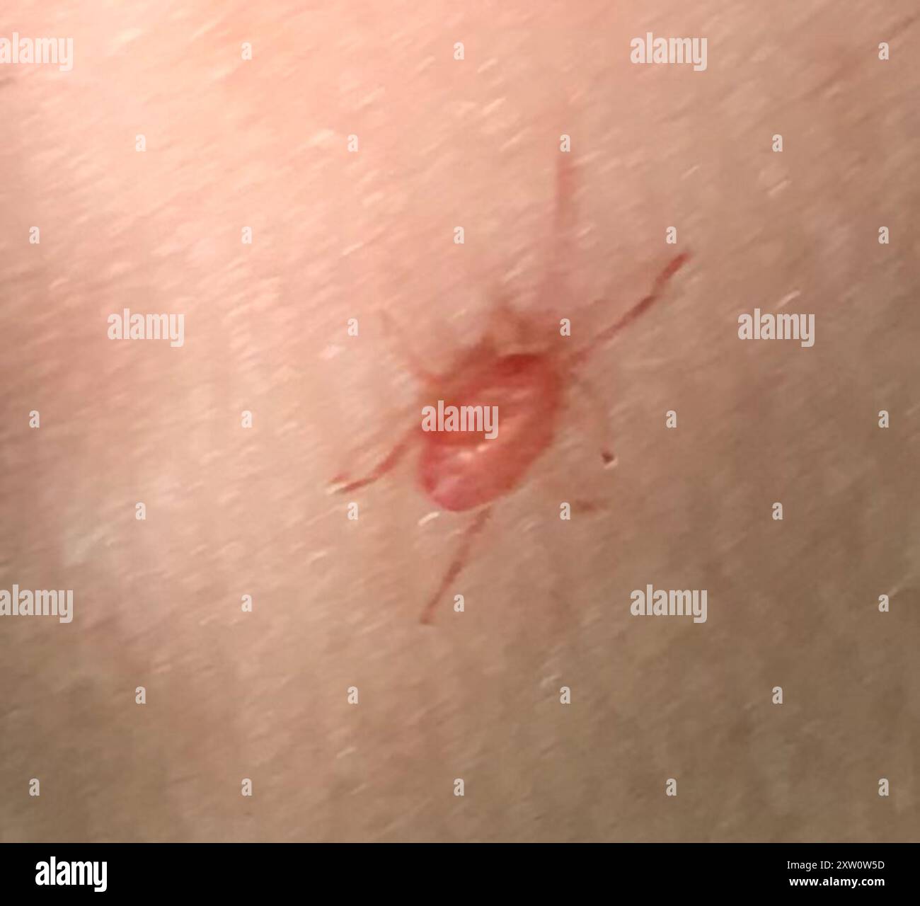 Sidewalk Mites (Balaustium) Arachnida Stock Photo - Alamy