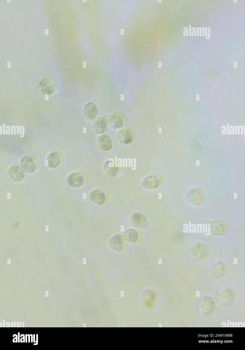 (Trechispora mollusca) Fungi Stock Photo - Alamy