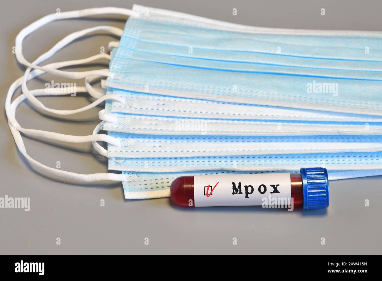 Blood collection tubes monkeypox (MPOX) with face mask. Test positive ...