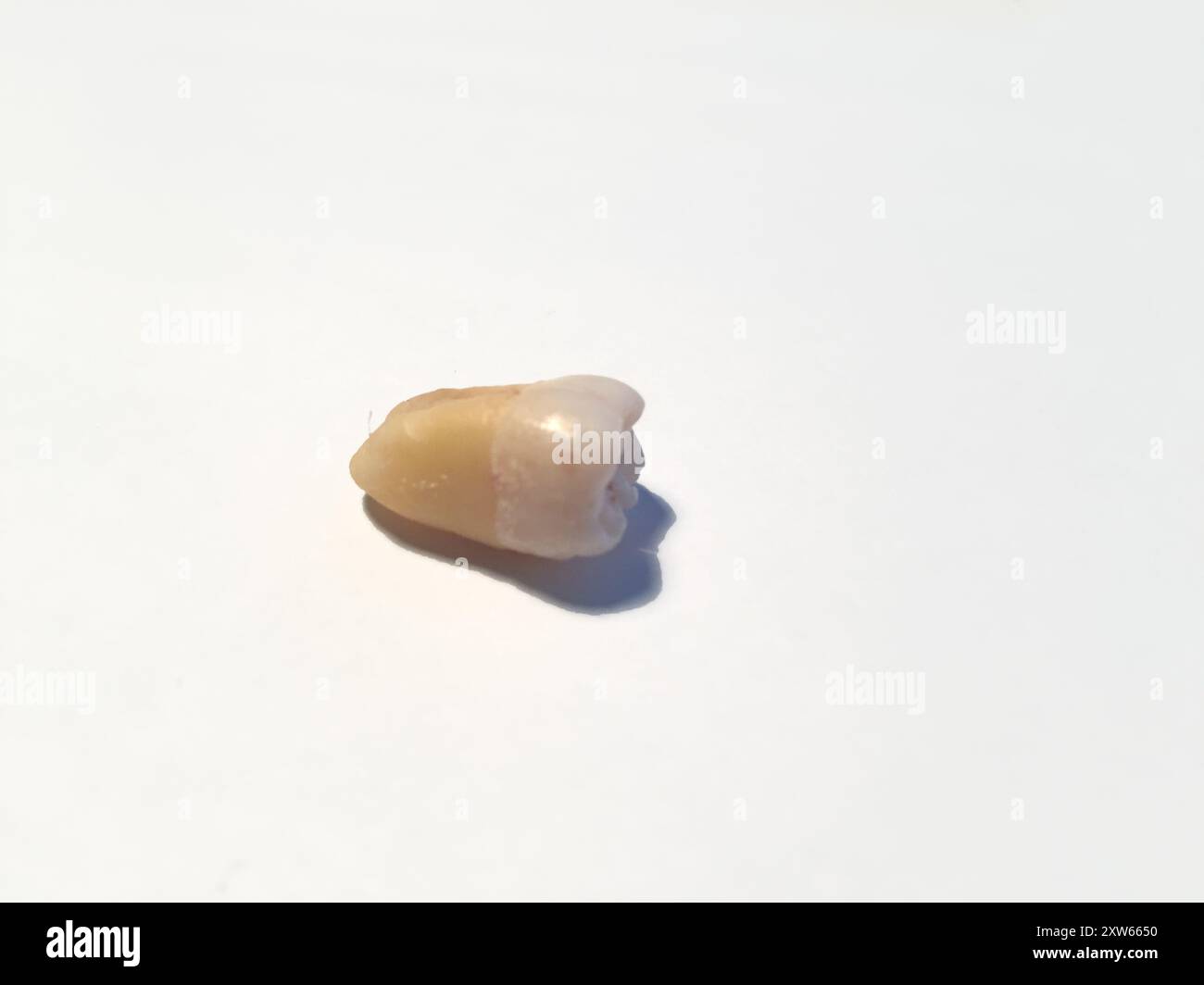 detail of wisdom teeth at the dentists deck,human,spare part Stock ...