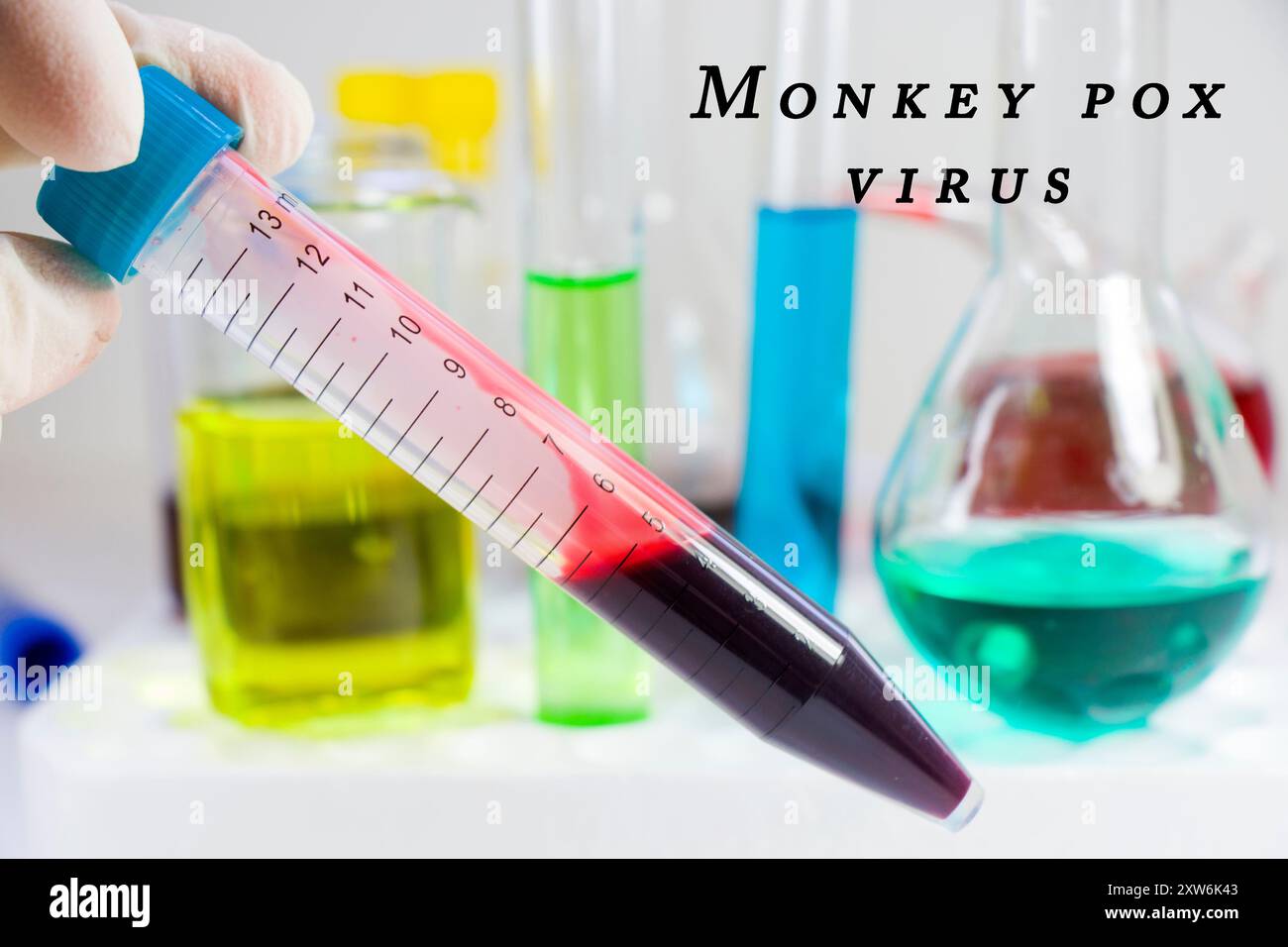 Mpox monkeypox virus, laboratory and blood test tube Stock Photo - Alamy