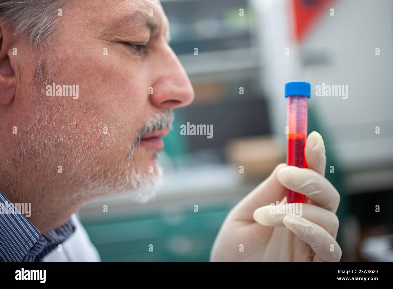 Scientist research blood cancer hi-res stock photography and images - Alamy
