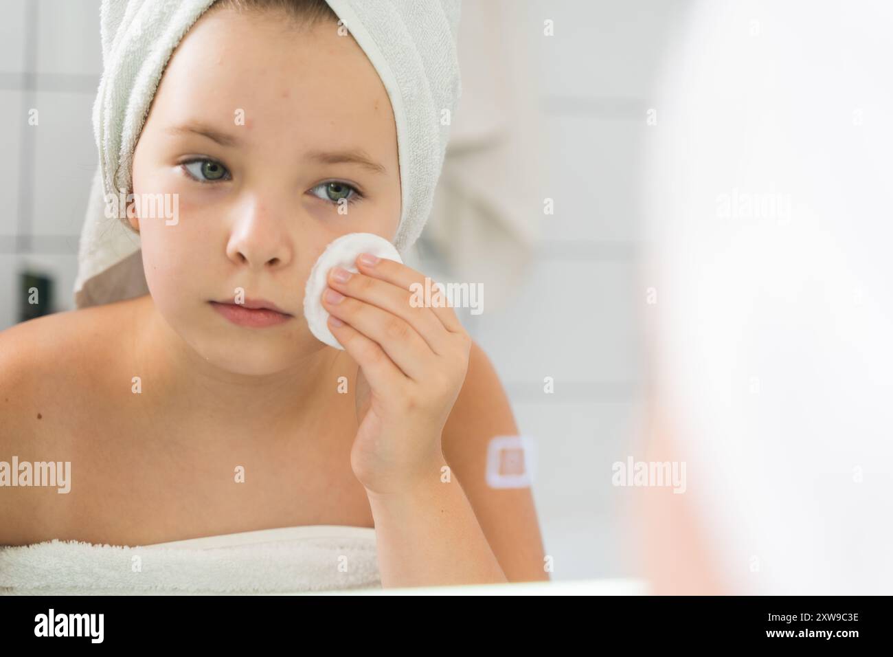 A little teenage girl wipes the skin of her face with a cotton mug with ...