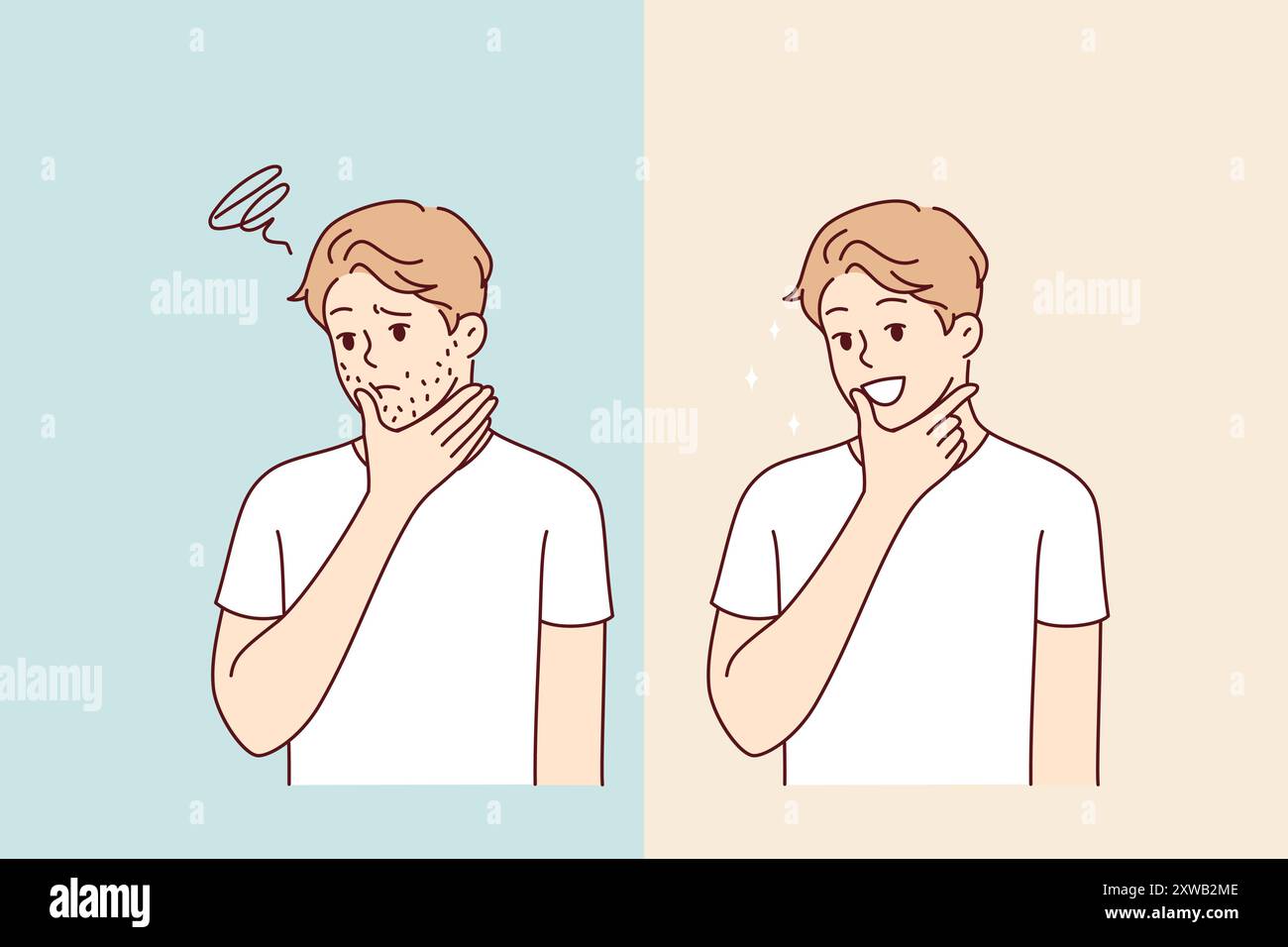 Pimples and spots on man face disappeared after using medical medicine ...