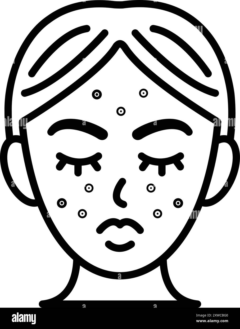 Rash skin hand woman Black and White Stock Photos & Images - Alamy