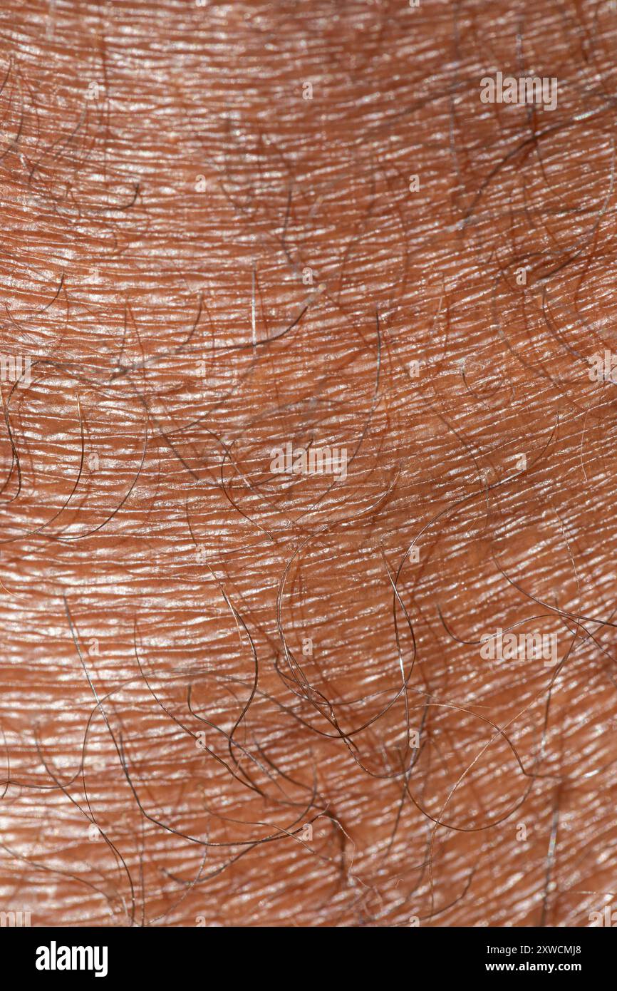 Extreme close up of human skin showing texture and hair follicles Stock ...