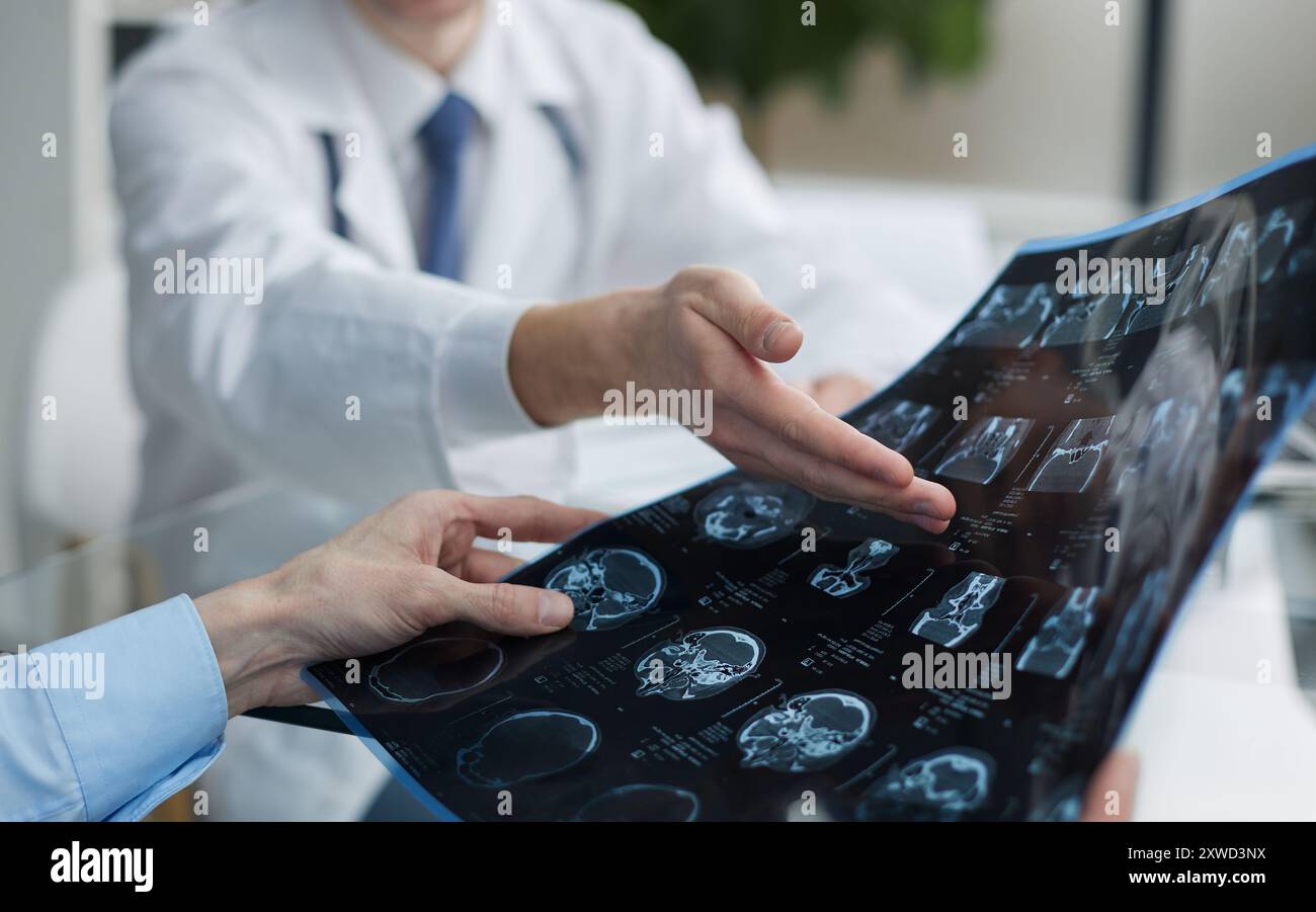 shows the x-ray image to the patient at the reception Stock Photo - Alamy
