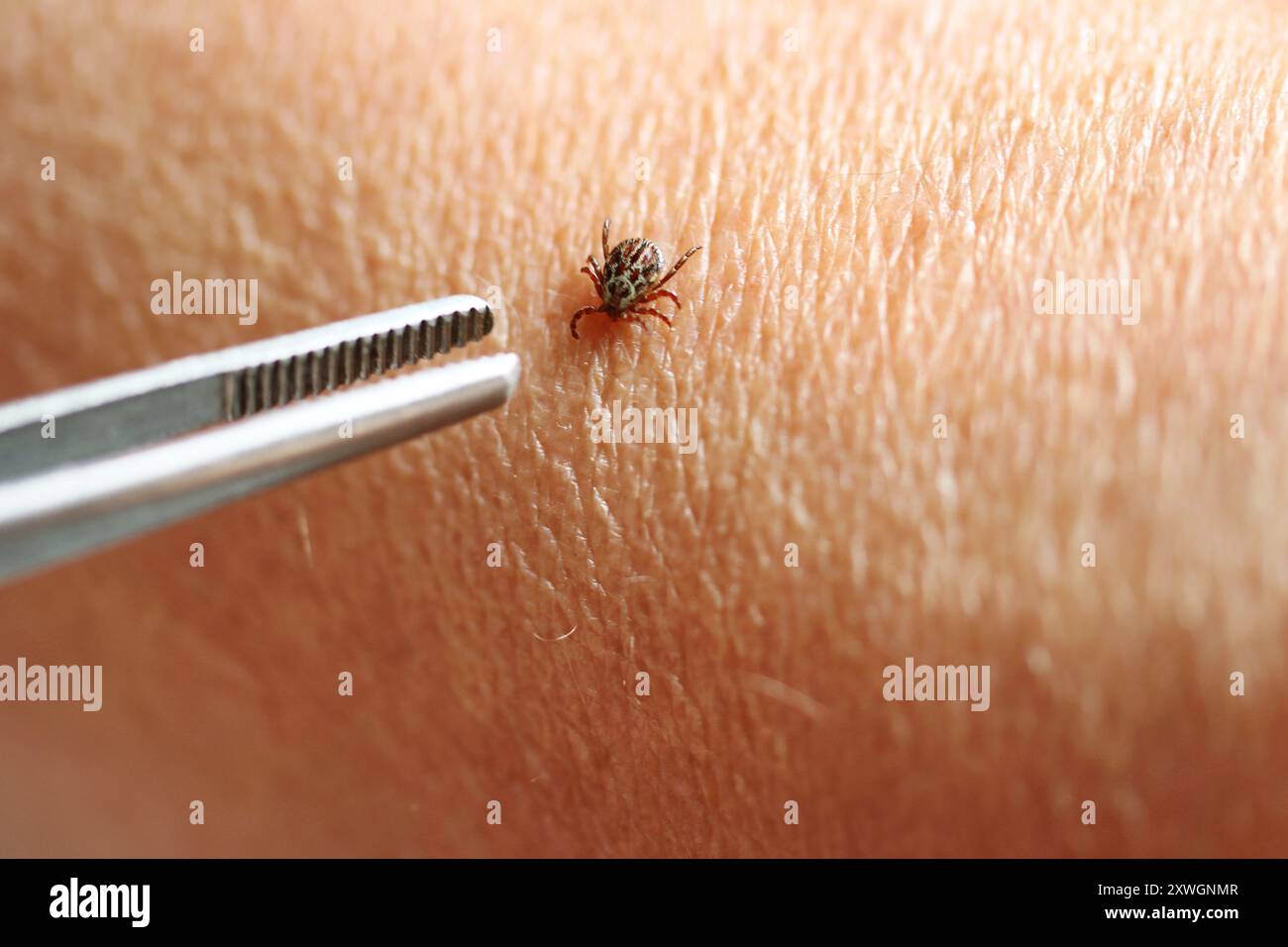 European castor bean tick, European sheep tick (Ixodes ricinus), Tick ...