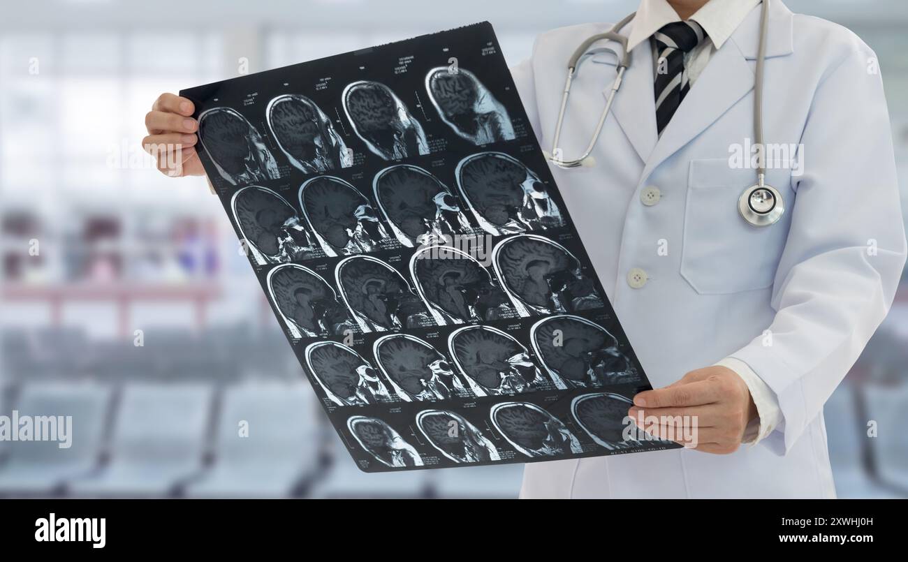 Doctor examining ray brain mri hi-res stock photography and images - Alamy
