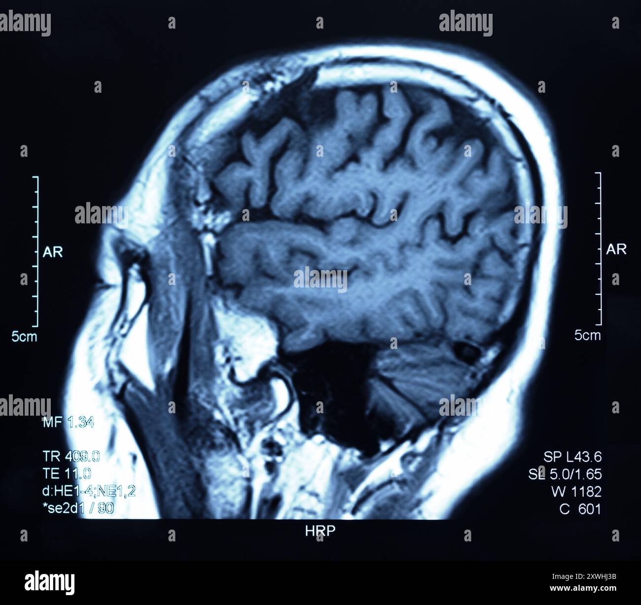 magnetic resonance image, mri scan of the brain Stock Photo - Alamy