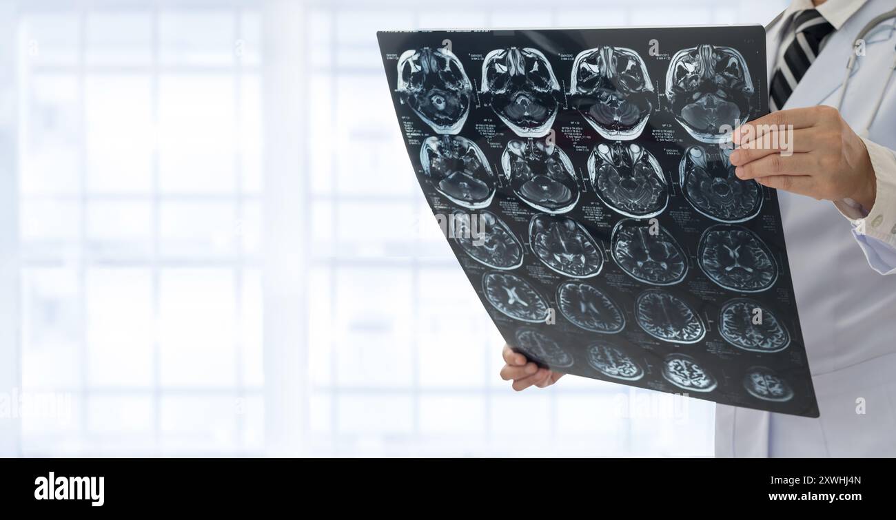 Medical Brain concept. Doctor check up x-ray film of the brain patient ...