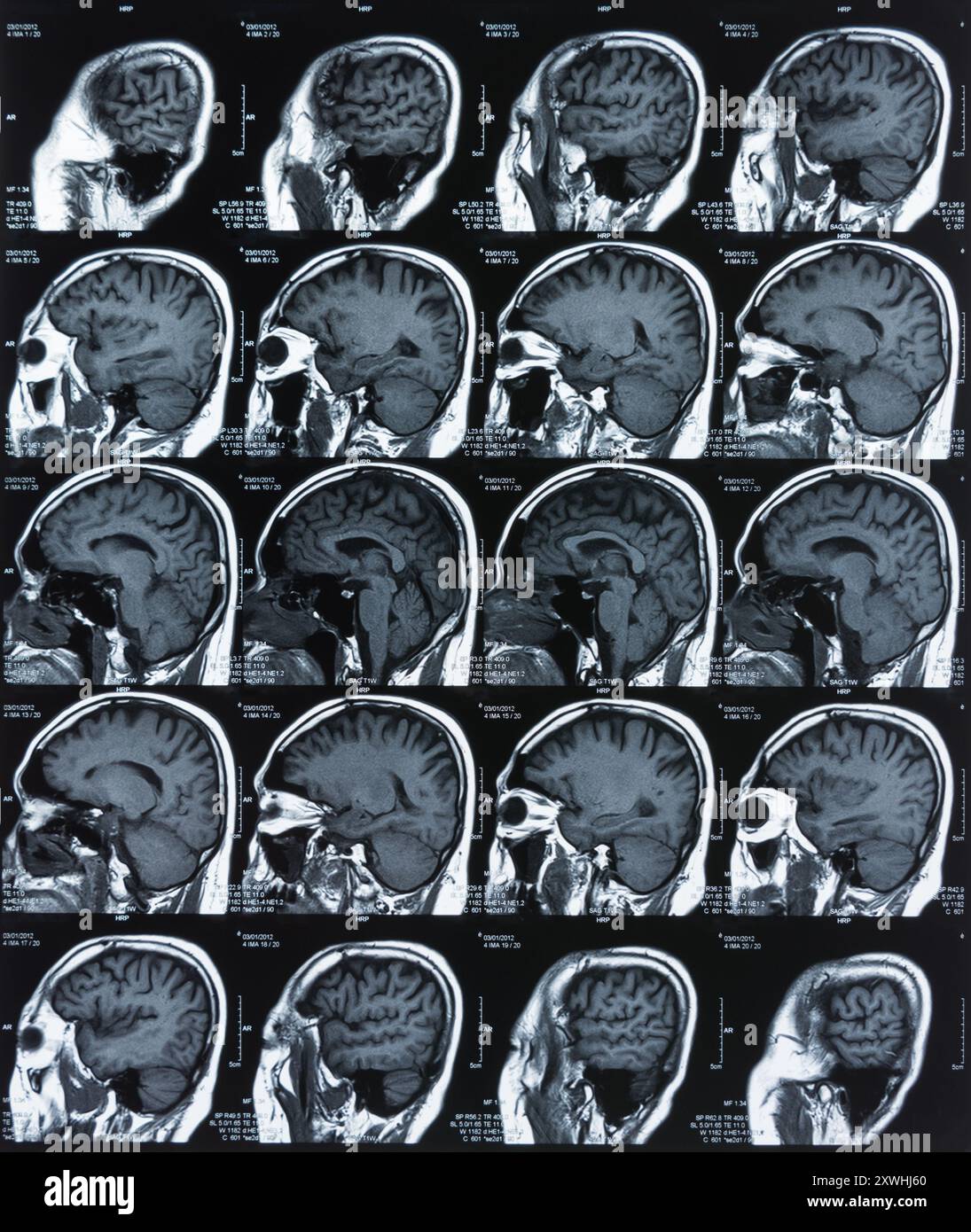 x-ray film image of brain by mri, ct scan for medical diagnosis Stock ...