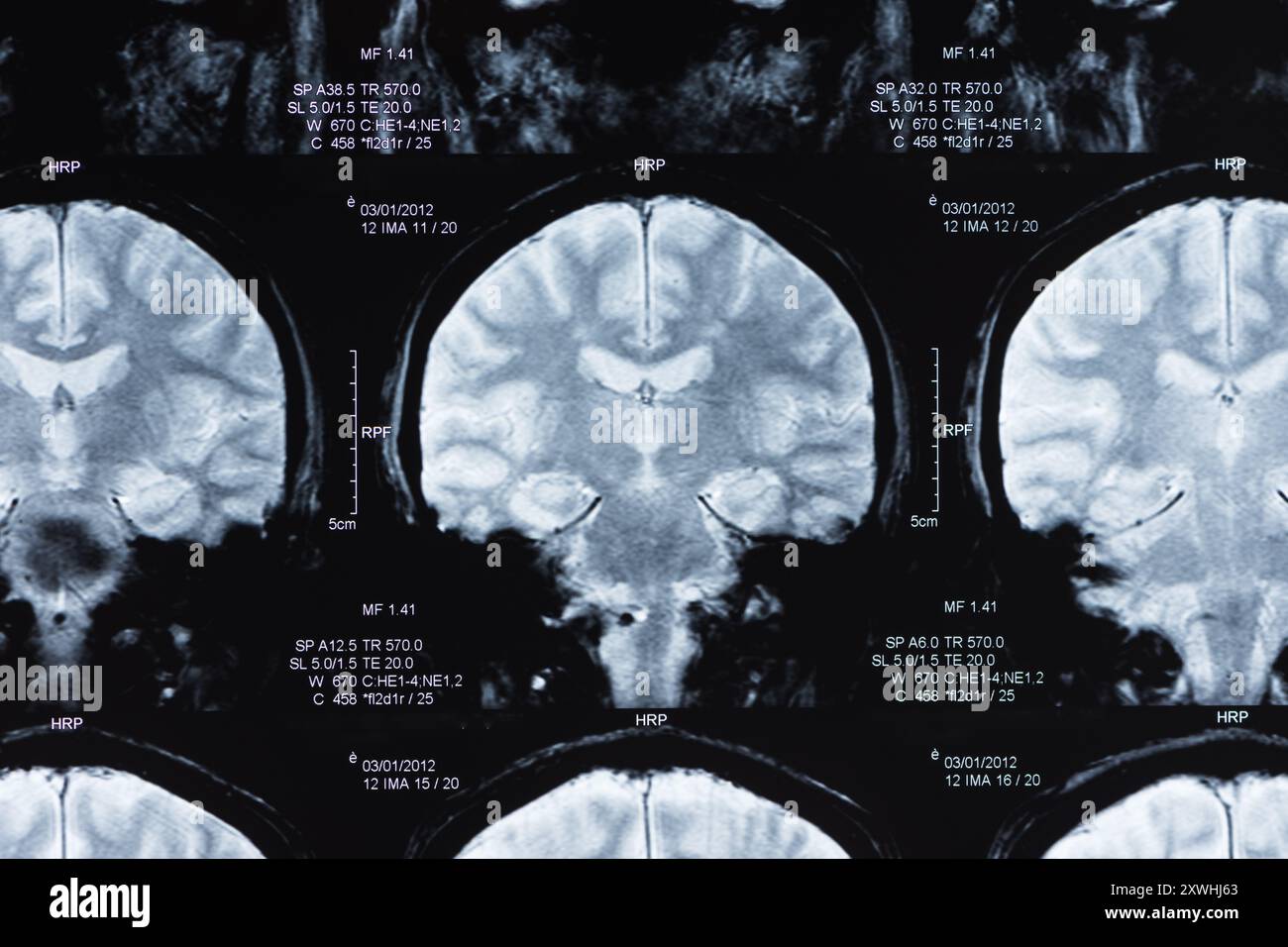 magnetic resonance image, mri scan of the brain Stock Photo - Alamy