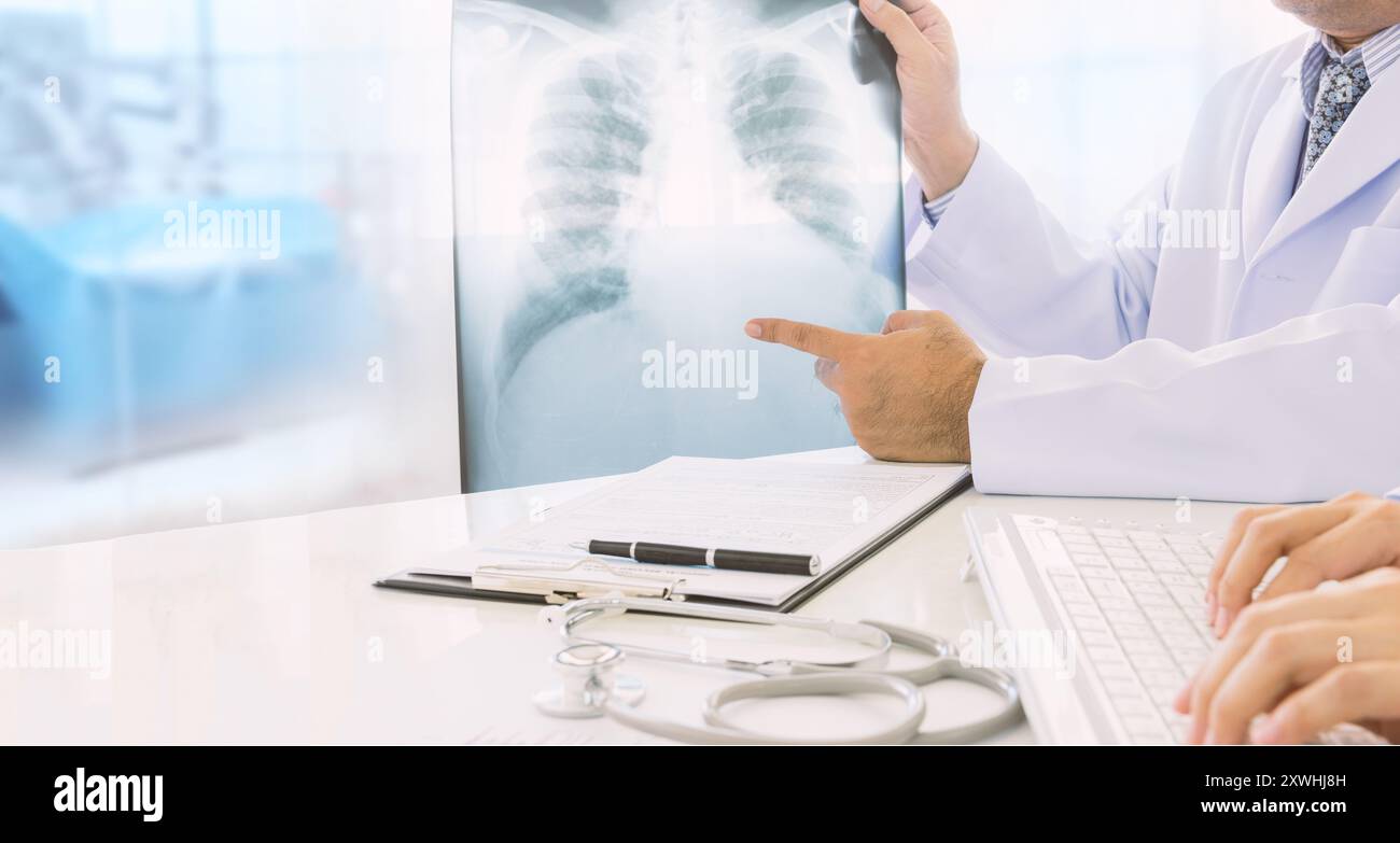 Doctor examining at lungs radiograph x-ray film of patient in operation ...