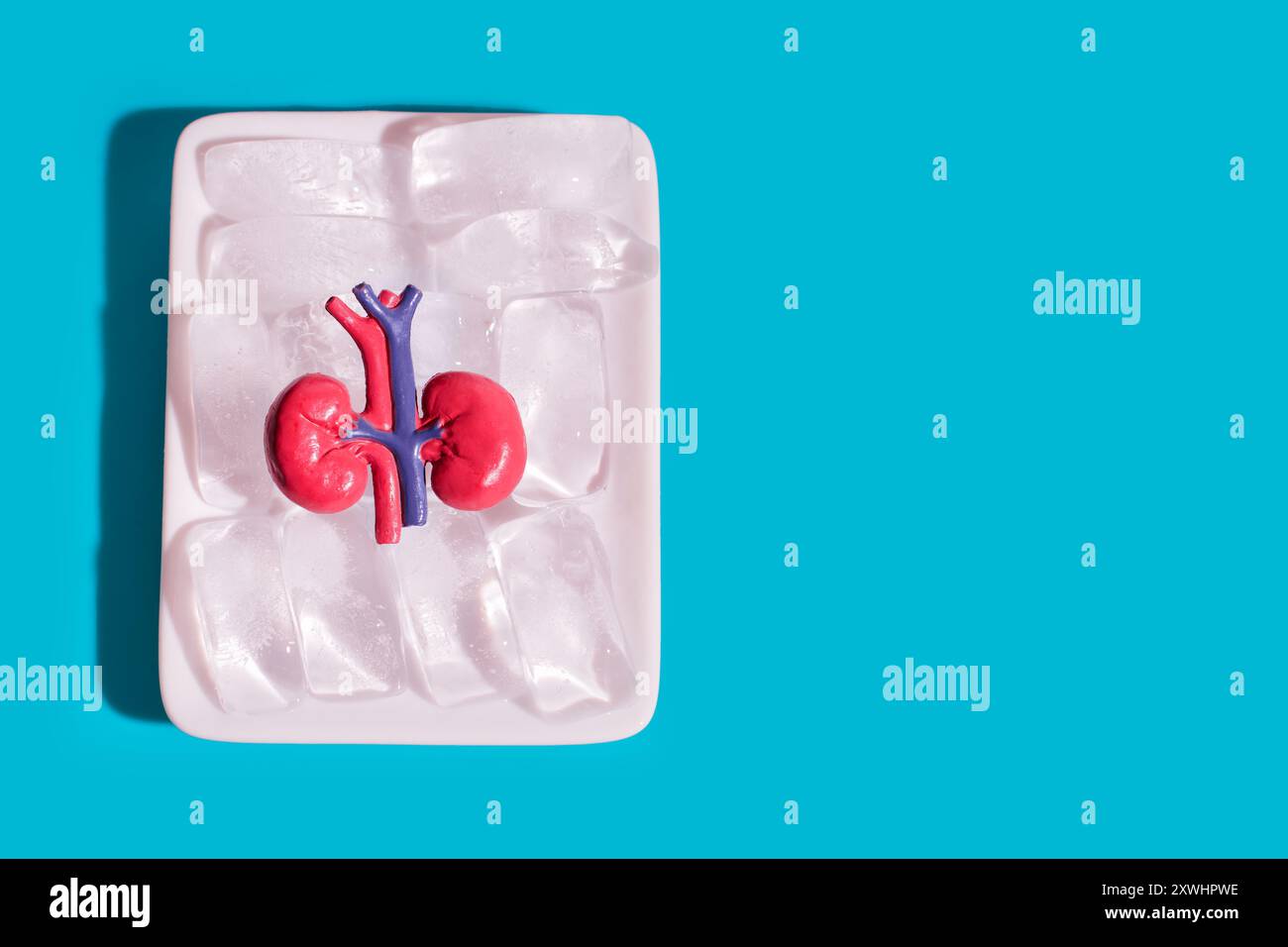 Top view of human kidneys model placed on ice cubes in white tray. Blue ...