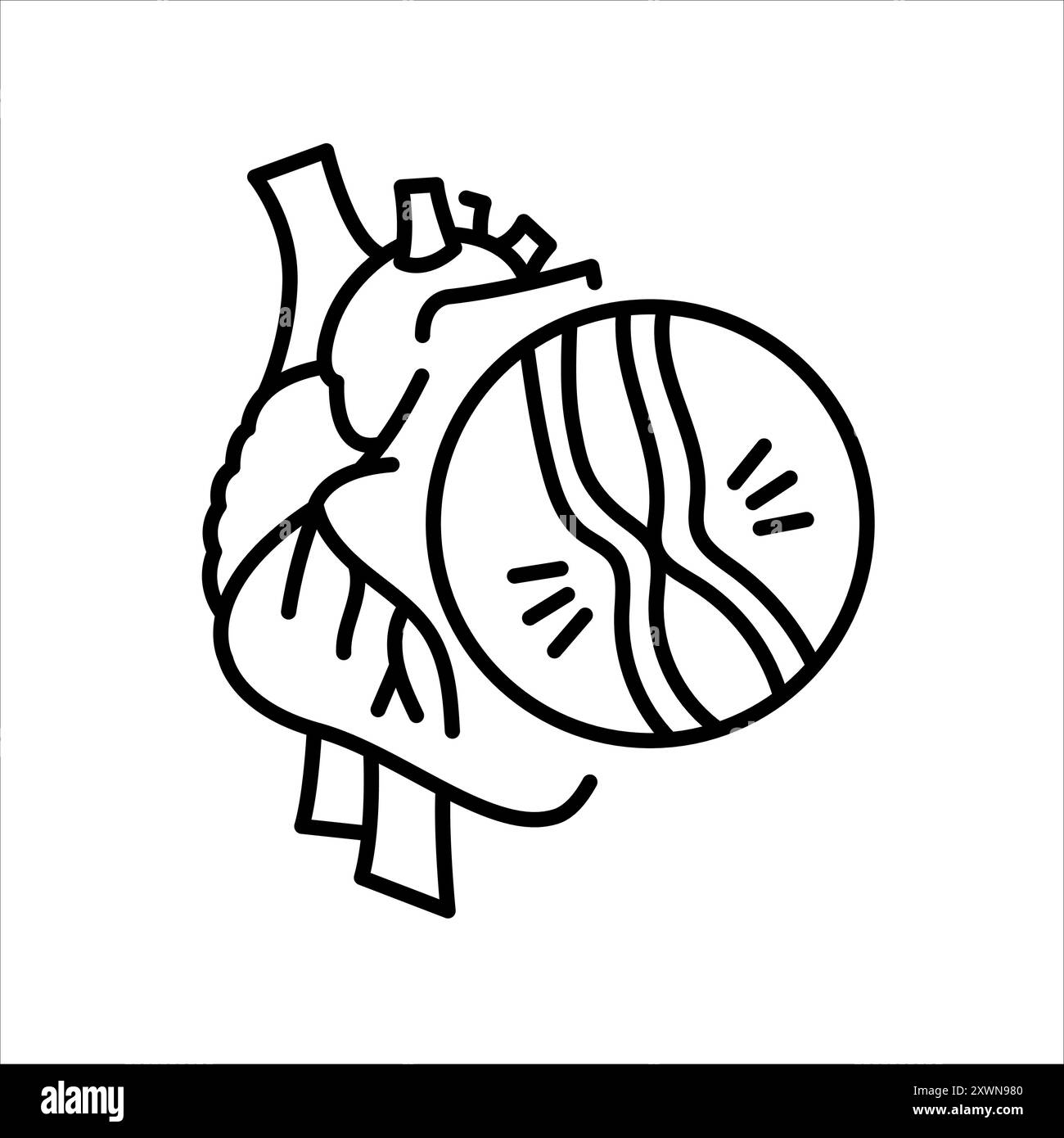 Pericardial vector vectors hi-res stock photography and images - Alamy