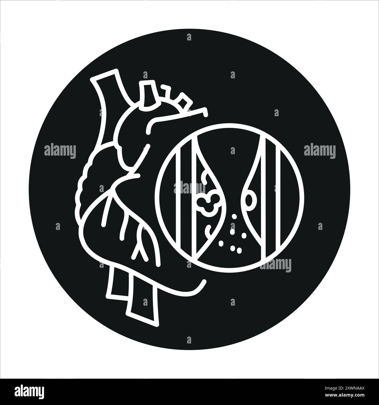 Coronary artery disease line black icon. Sign for web page, mobile app ...