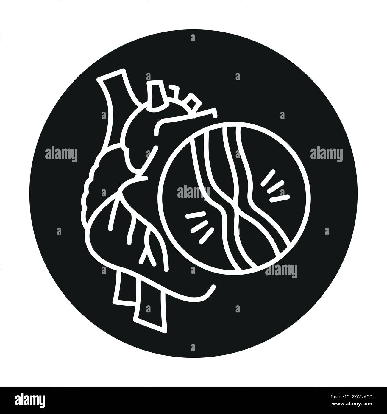 Atrial Stock Vector Images - Alamy