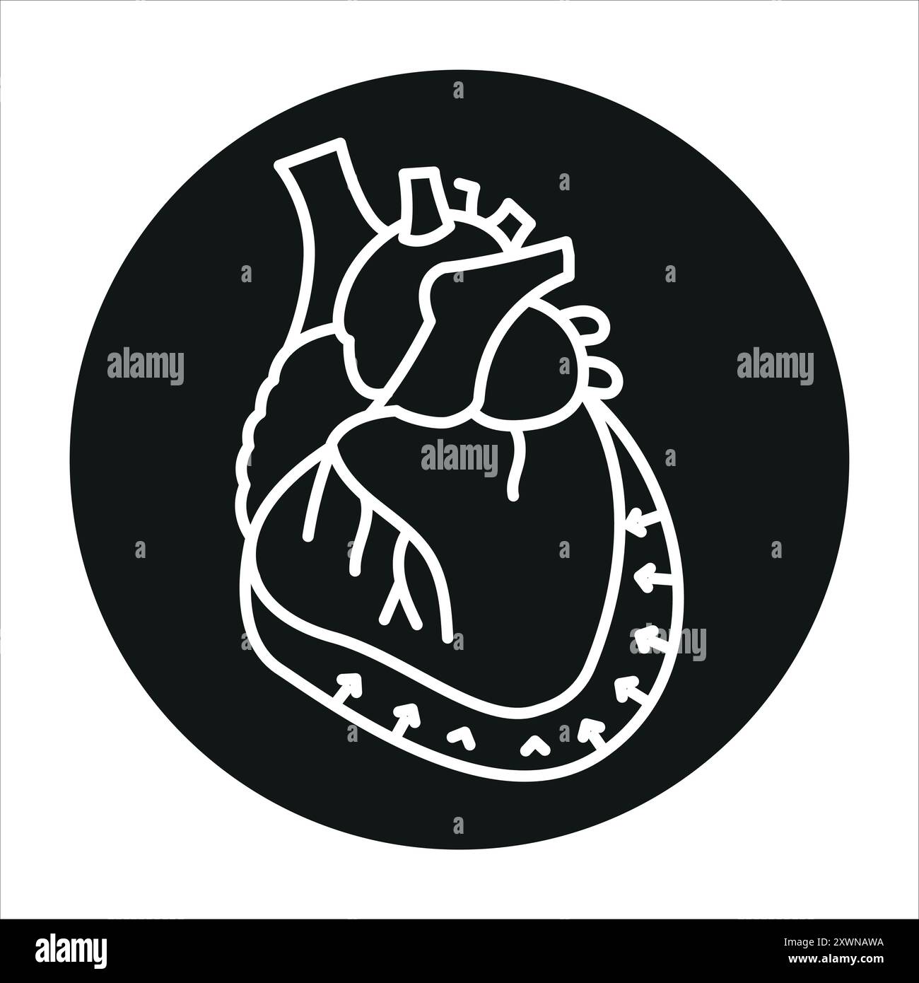 Cardiomegaly vector vectors hi-res stock photography and images - Alamy