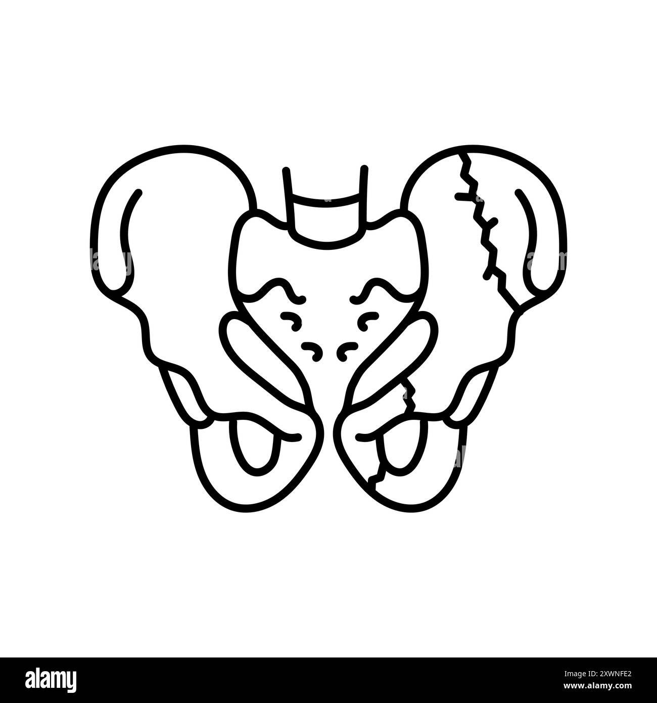Pelvic Fracture Line Black Icon Sign For Web Page Mobile App Button Logo Vector Isolated