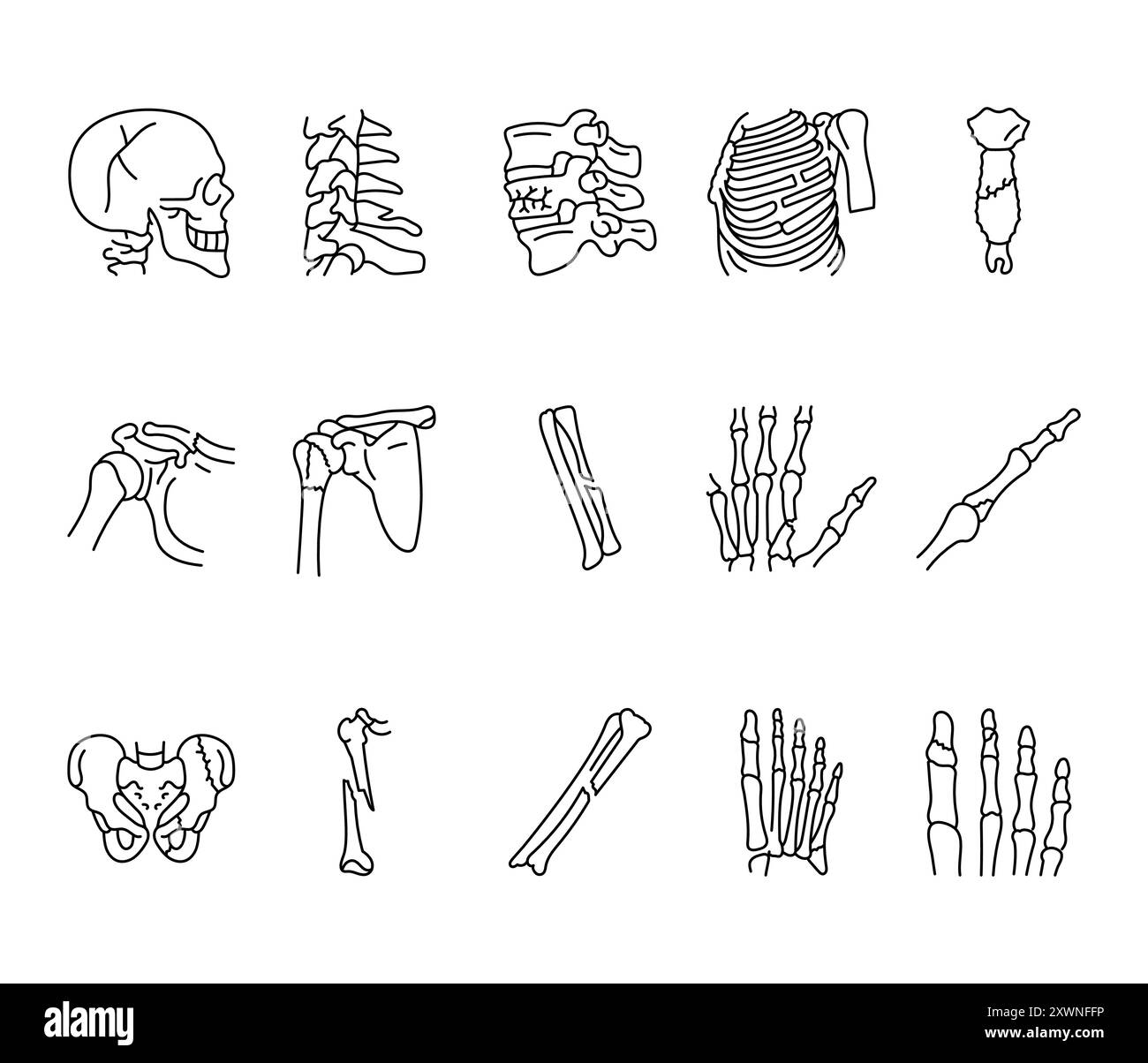 Fractures line black icons set. Signs for web page, mobile app, button ...