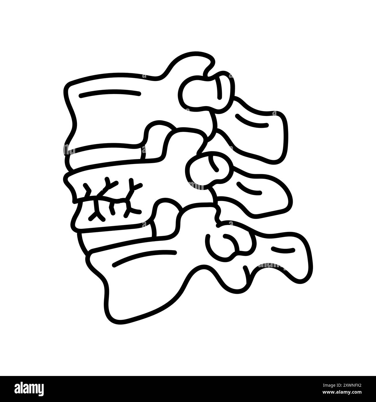 Vertebral compression fracture line black icon. Sign for web page ...