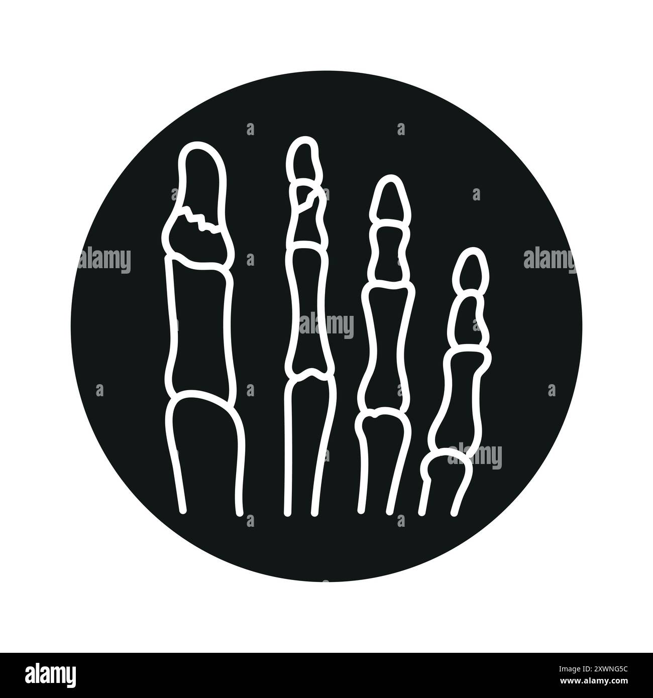 Broken toe x ray Cut Out Stock Images & Pictures - Alamy