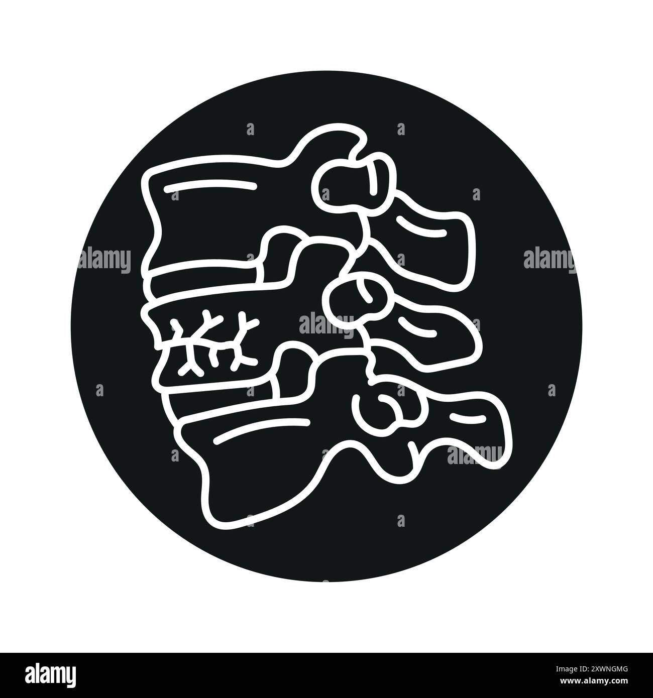 Vertebral compression fracture line black icon. Sign for web page ...