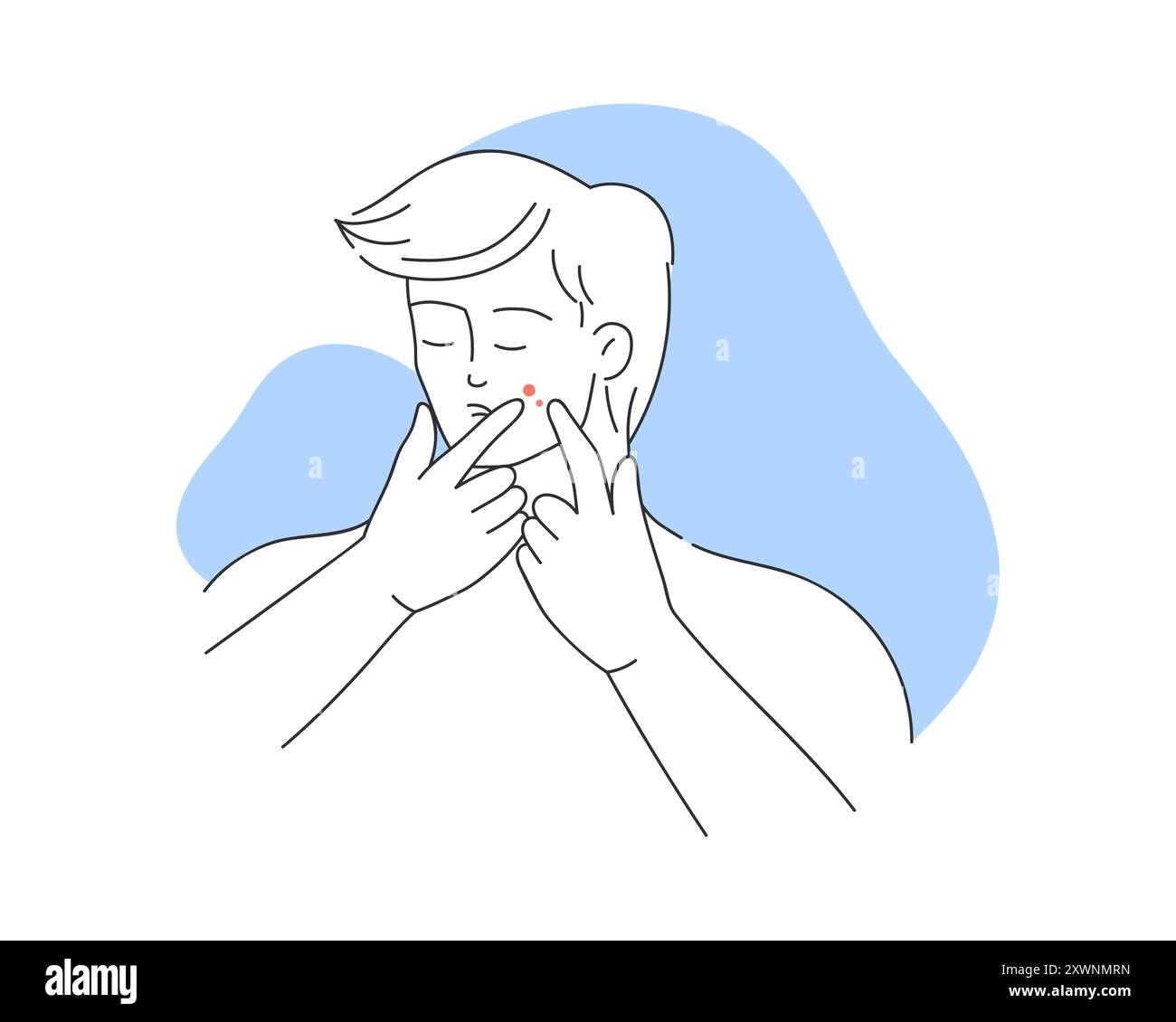 Sad young man with acne and pimples on face, infection trouble vector ...