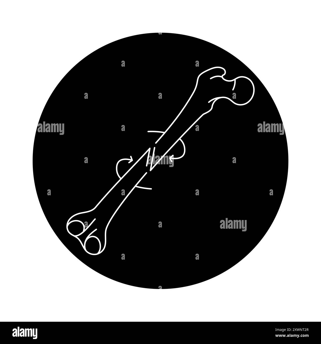 Spiral bone fracture line icon. Vector isolated element. Editable ...
