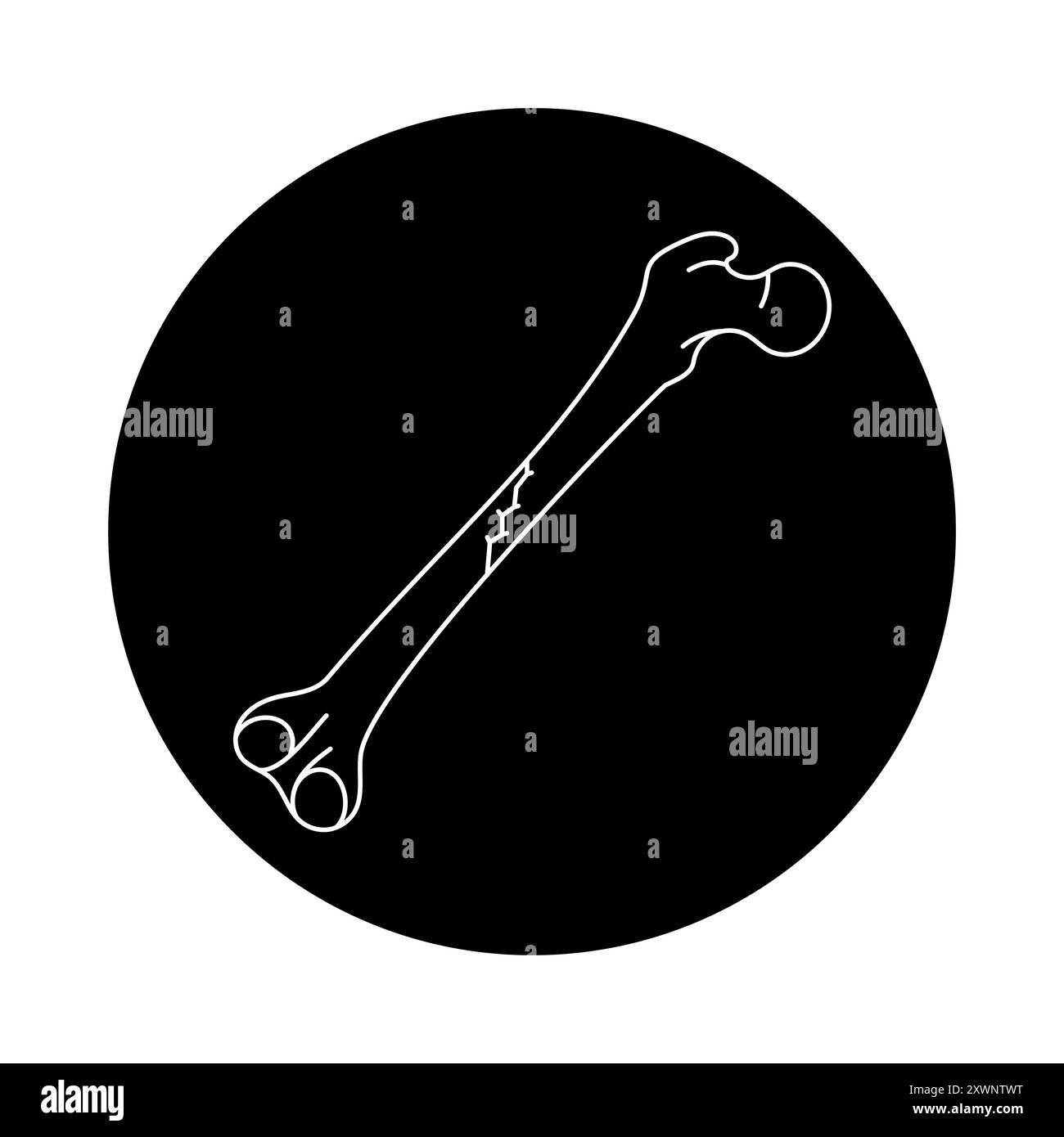 Oblique Nondisplaced Bone Fracture Line Icon Vector Isolated Element Editable Stroke Stock