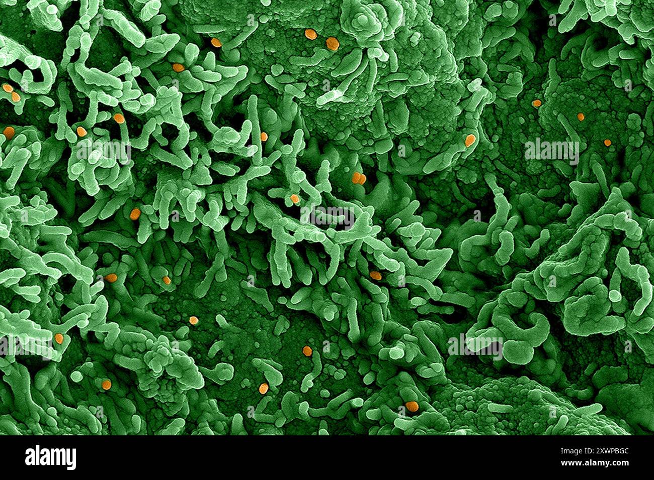This colorized electron microscope image provided by the National ...
