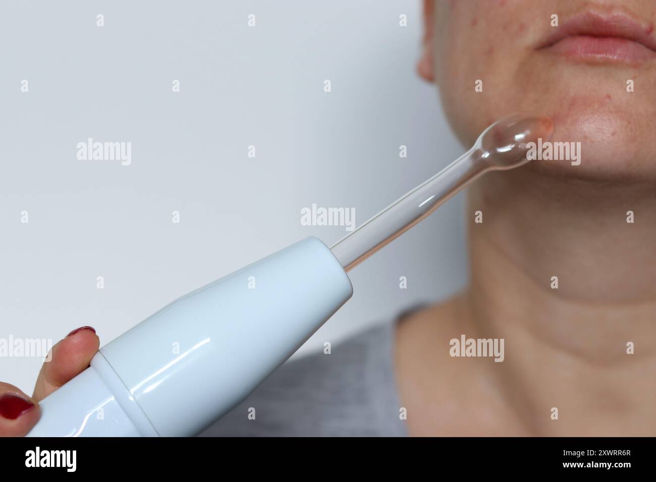 High frequency device hi-res stock photography and images - Alamy