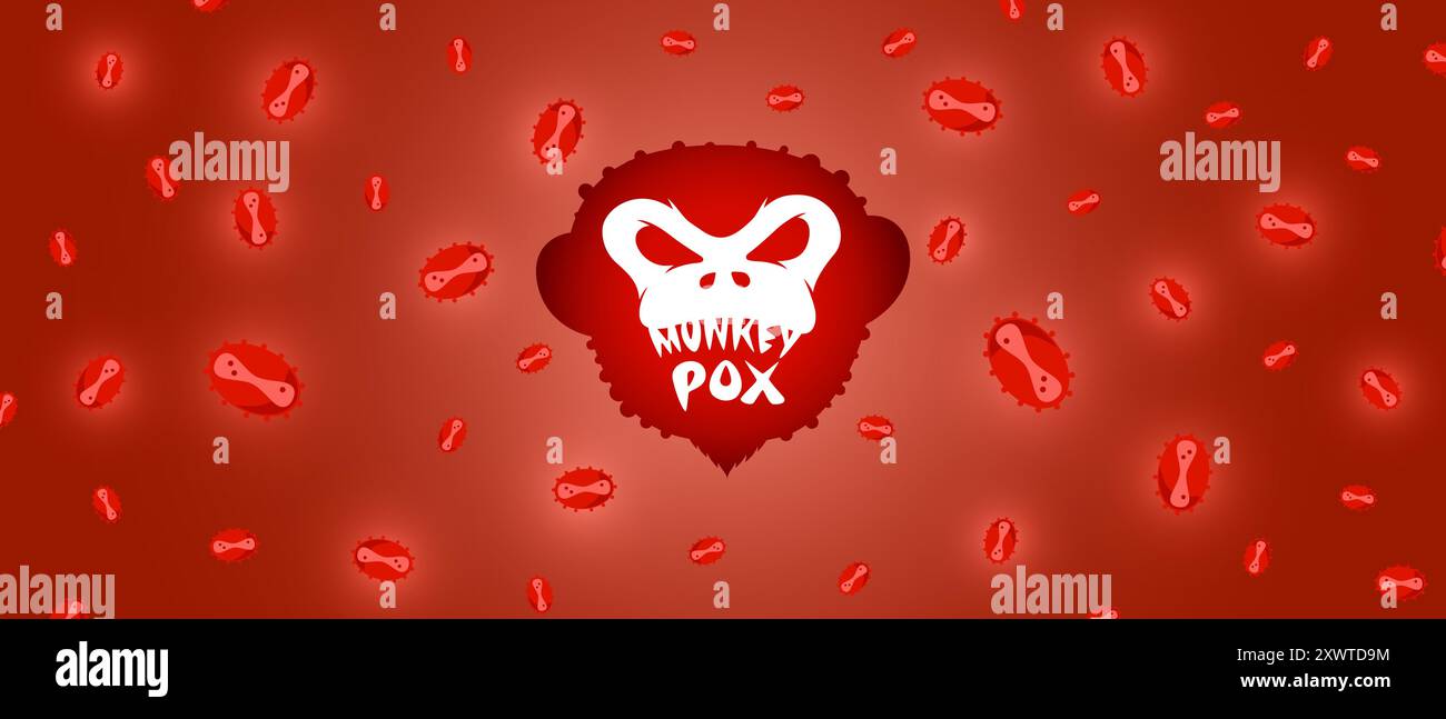 Monkeypox virus infection warning banner. Monkey pox disease outbreak ...