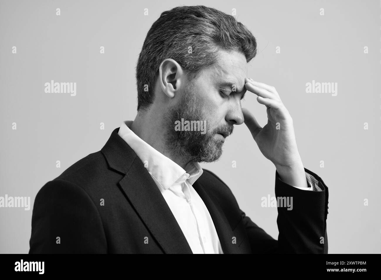 Overworked man feeling migraine head strain. Stressed, tired man with ...