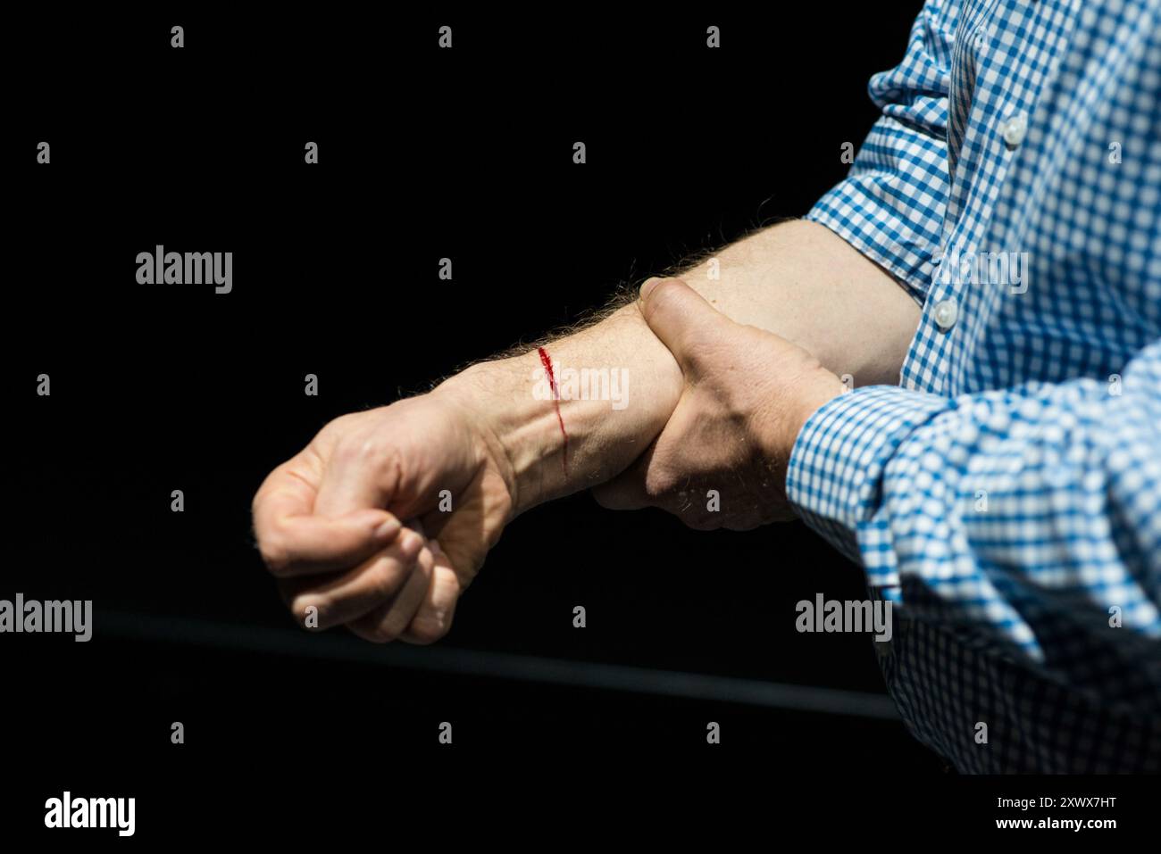 The image captures a close-up of a man's arm with a noticeable cut. It ...