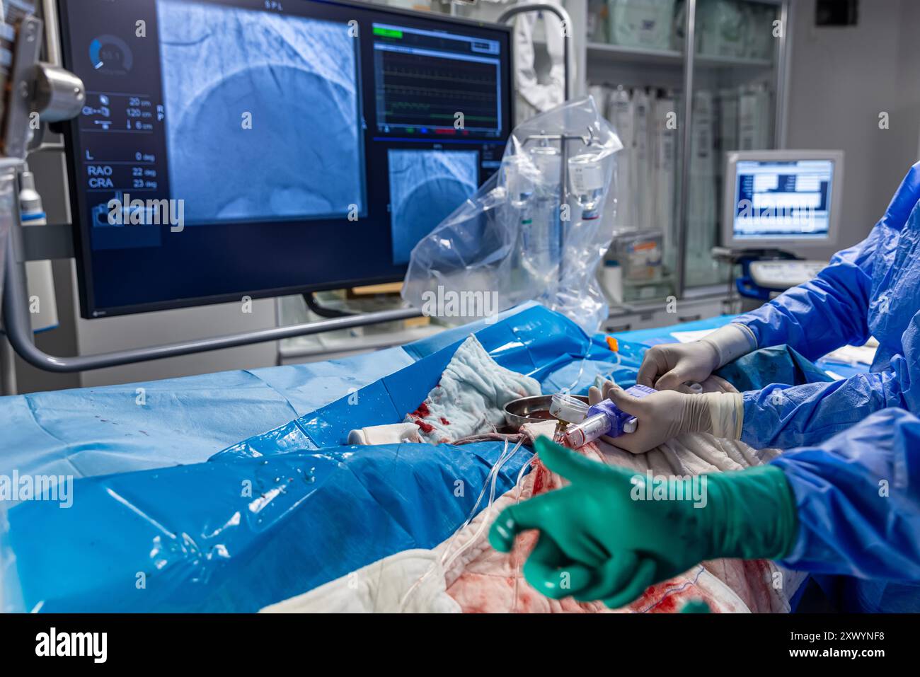 Denizli Turkey-28 February 2024; Doctors conduct a diagnostic operation ...