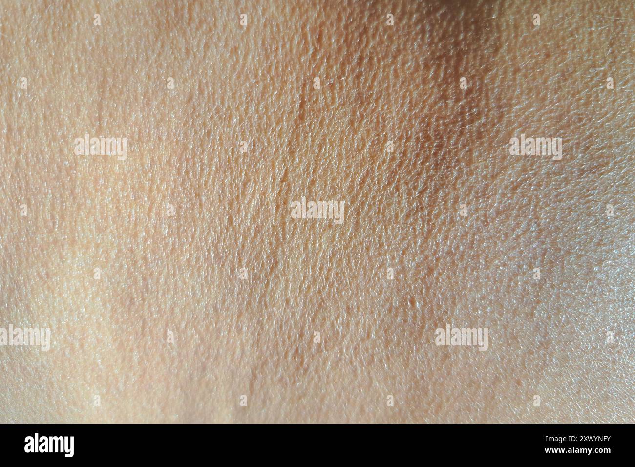 Skin texture of a white man, close-up. Human anatomy Stock Photo - Alamy
