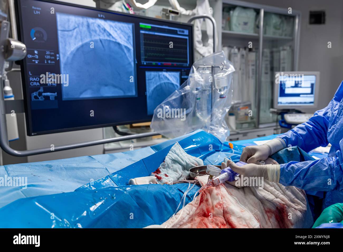 Denizli Turkey-28 February 2024; Doctors conduct a diagnostic operation ...