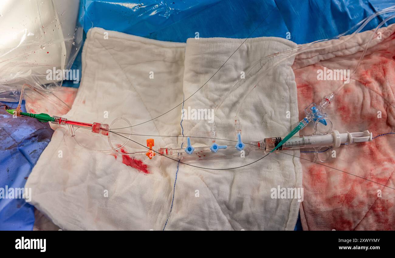 Heart stent placement process in operating room. Heart doctor inserting ...