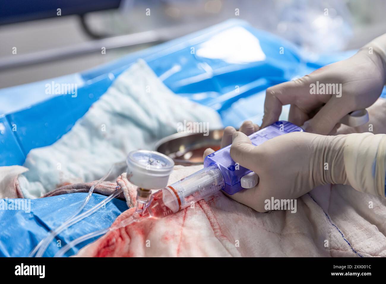Heart stent placement process in operating room. Heart doctor inserting ...
