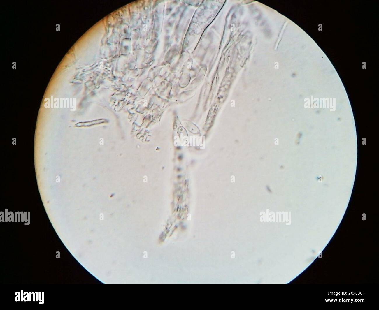 Operculate Ascomycetes (Pezizomycetes) Fungi Stock Photo - Alamy