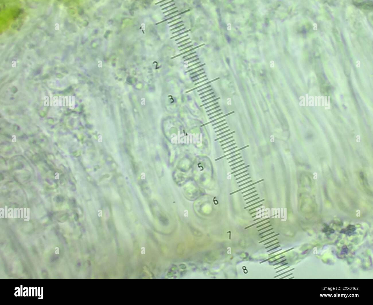 (Myriolecis sambuci) Fungi Stock Photo - Alamy