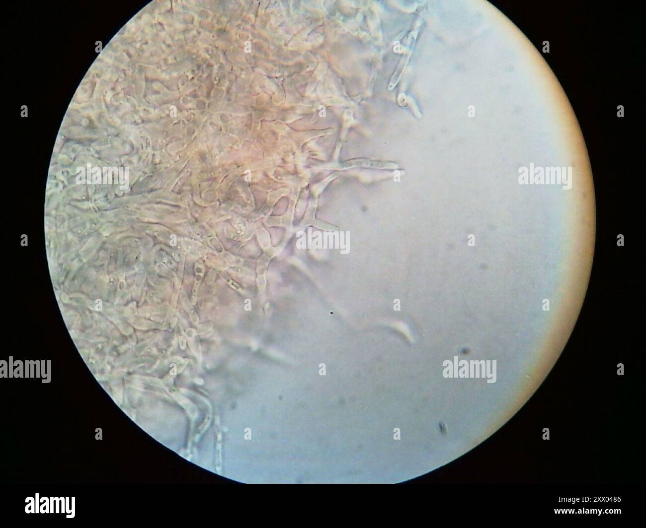 Serratia marcescens hi-res stock photography and images - Alamy