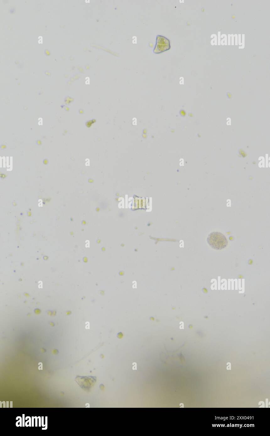 Droplet Notchwort (Lophozia guttulata) Plantae Stock Photo - Alamy