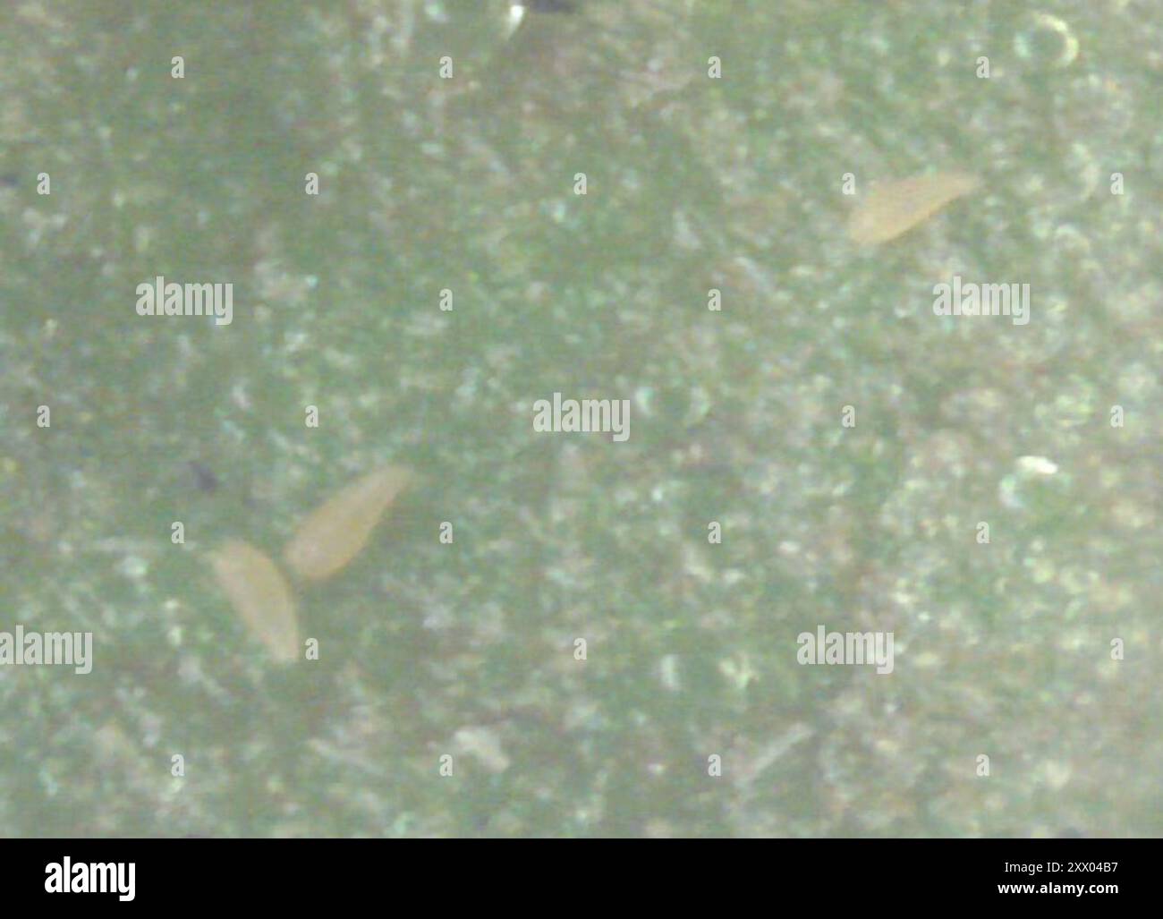 Gall and Rust Mites (Eriophyidae) Arachnida Stock Photo - Alamy