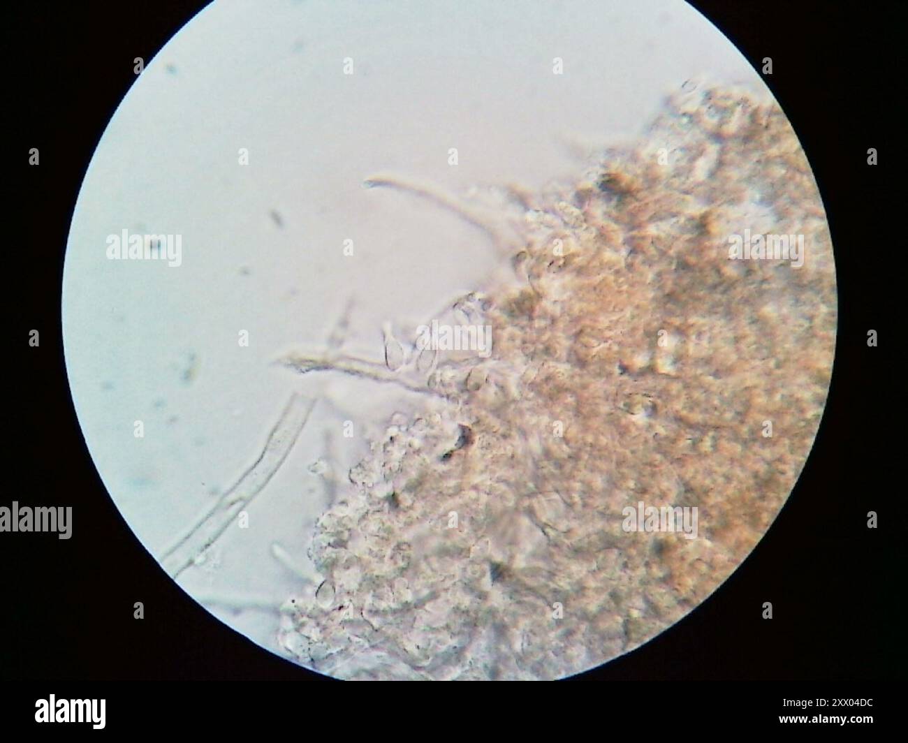 Serratia marcescens hi-res stock photography and images - Alamy