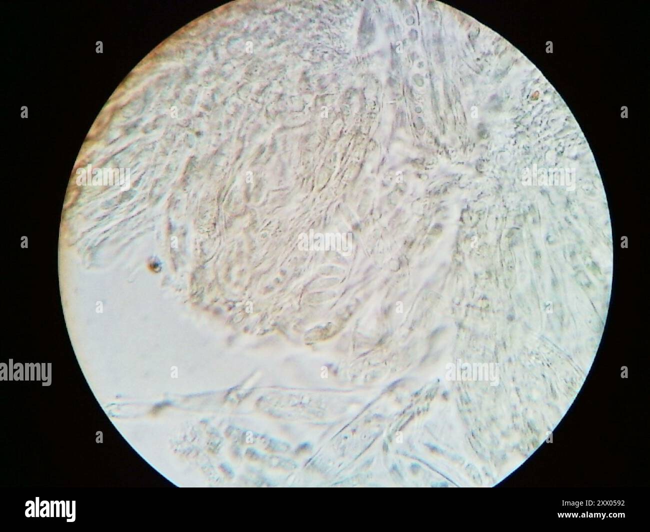 Operculate Ascomycetes (Pezizomycetes) Fungi Stock Photo - Alamy