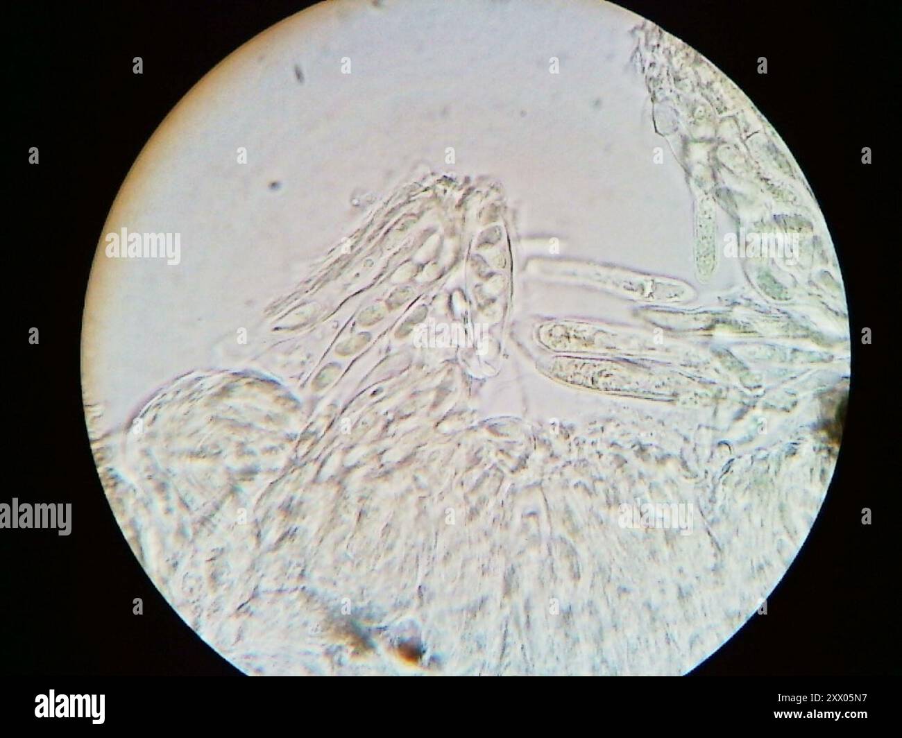 Operculate Ascomycetes (Pezizomycetes) Fungi Stock Photo - Alamy
