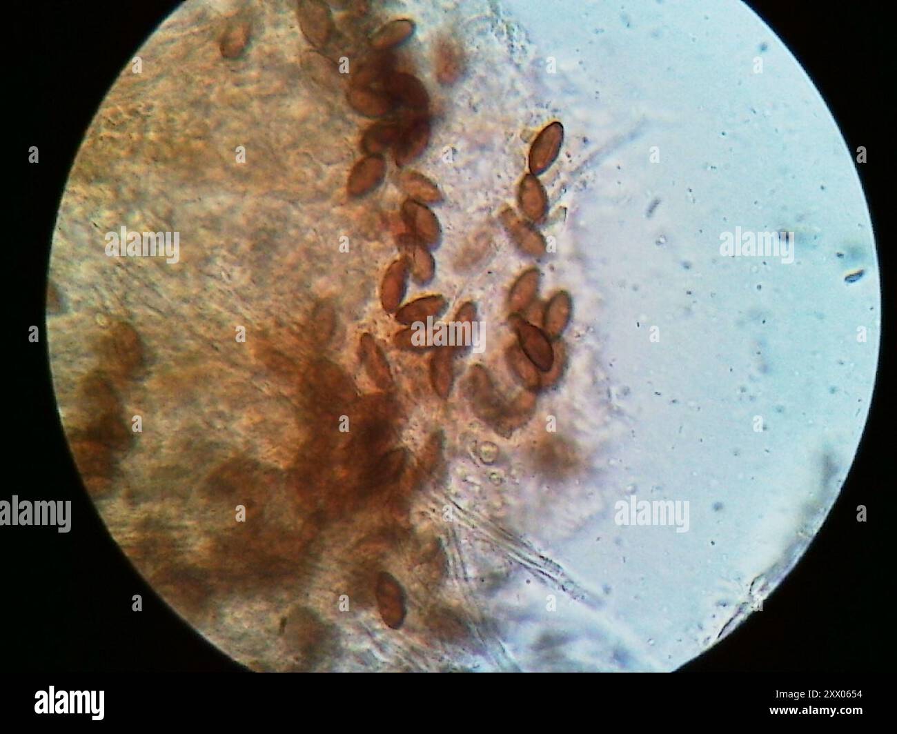 (Rosellinia subiculata) Fungi Stock Photo - Alamy